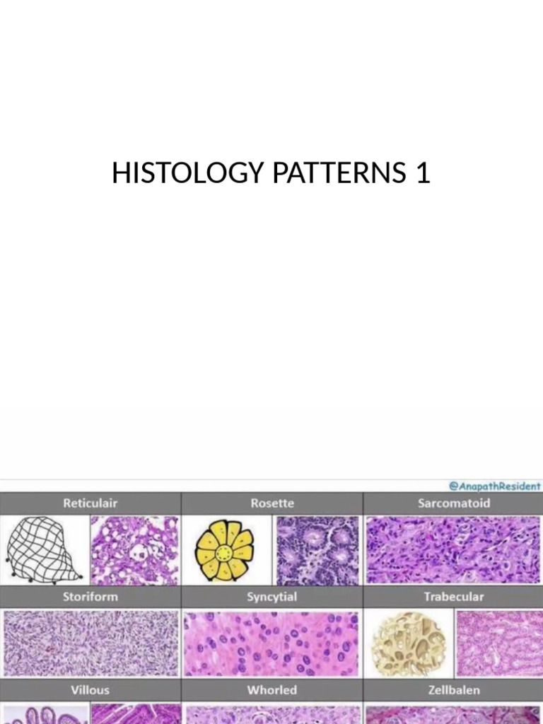 Histological Pattern | PDF