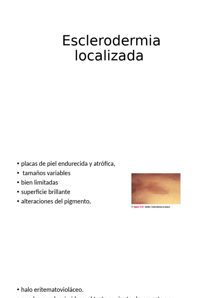 Esclerodermia Localizada | PDF