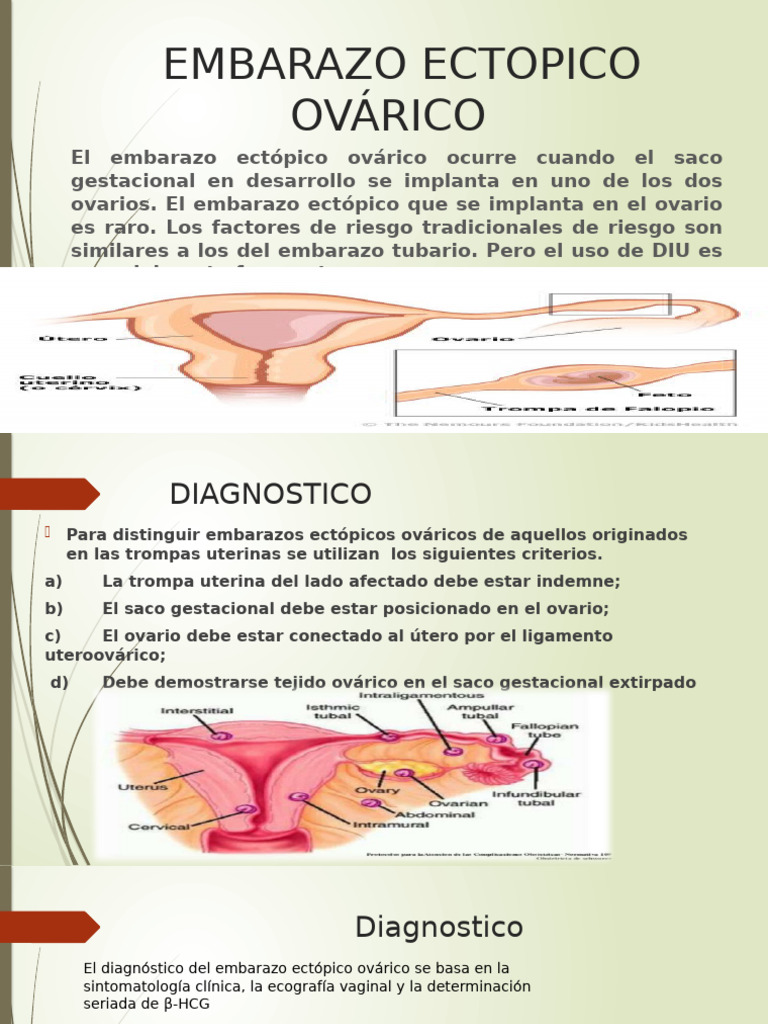 Embarazo Ectópico Ovárico: Diagnóstico y Tratamiento | PDF | El ...