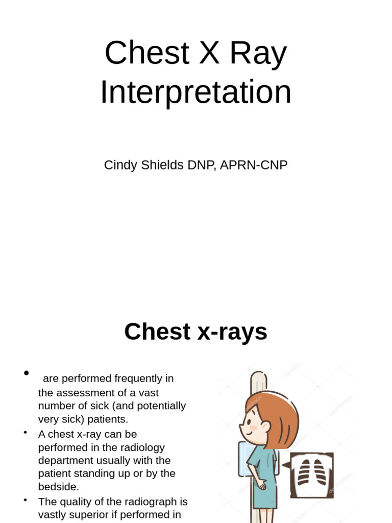 Chest X Rayd - T | PDF | X Ray | Thorax
