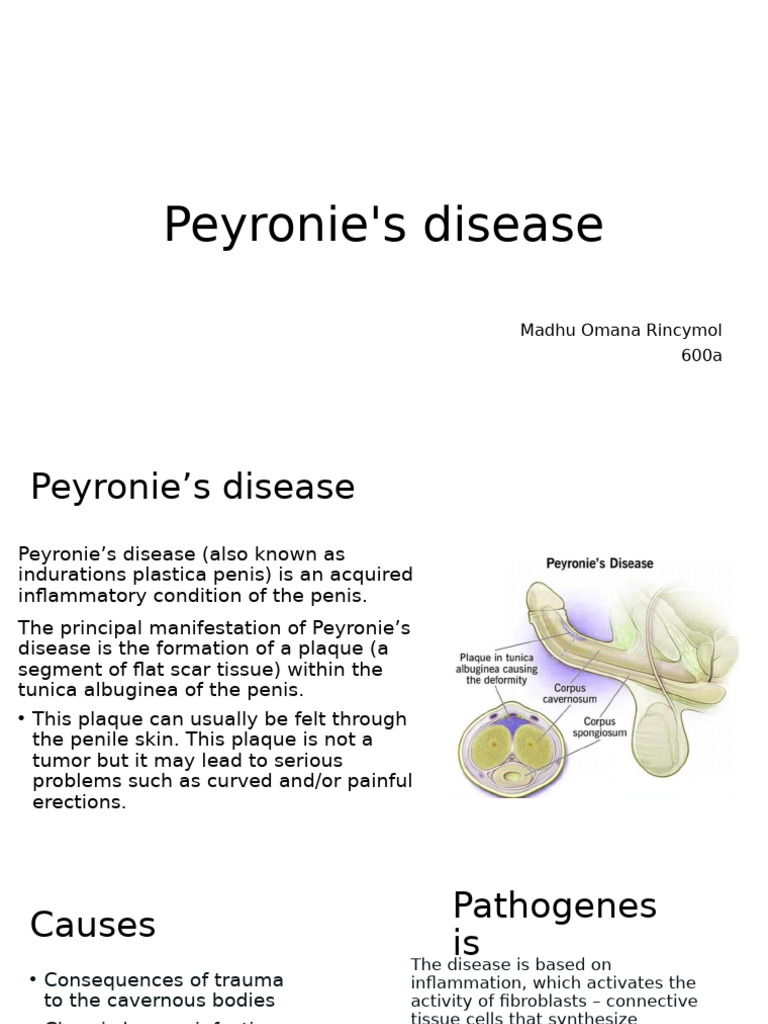 Peyronie's Disease Rincy 600A | PDF | Clinical Medicine | Diseases And ...