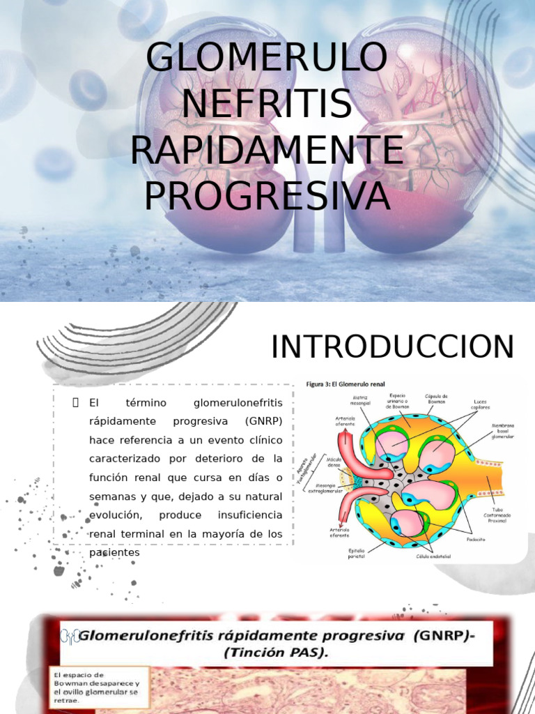 GLOMERULONEFRITIS | PDF | Especialidades Medicas | Enfermedades y trastornos