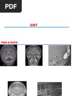 AJCC 8th Edition Head and Neck Staging | PDF | Human Head And Neck ...