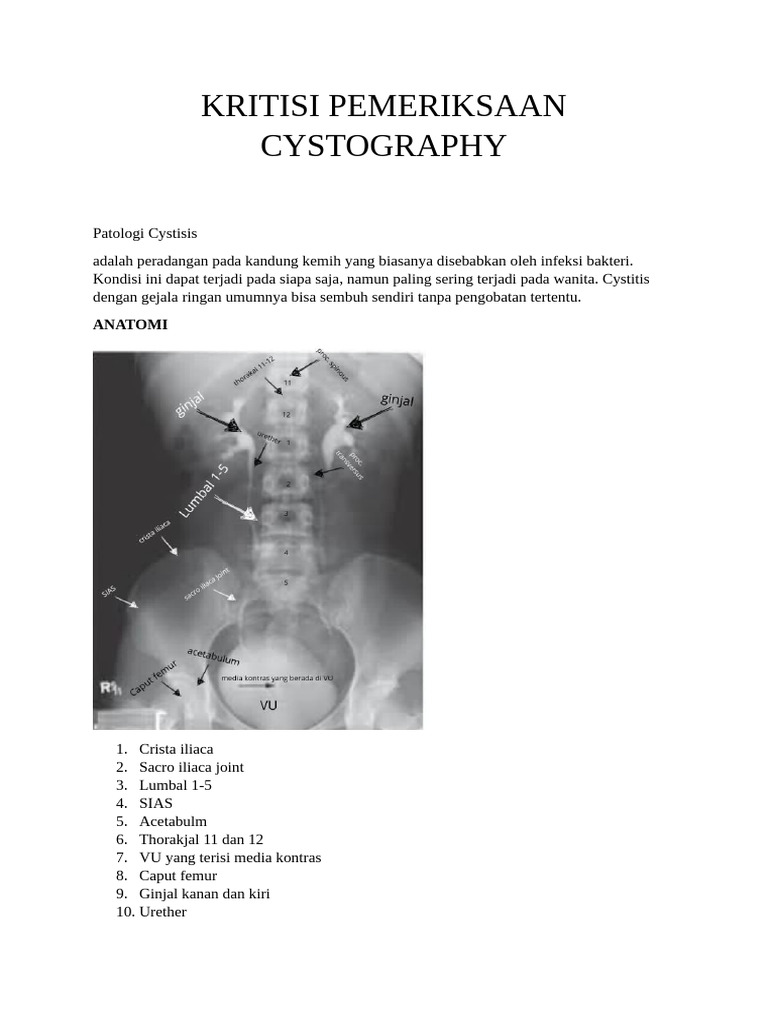 Kritisi Pemeriksaan Cystography Reyy-1 | PDF