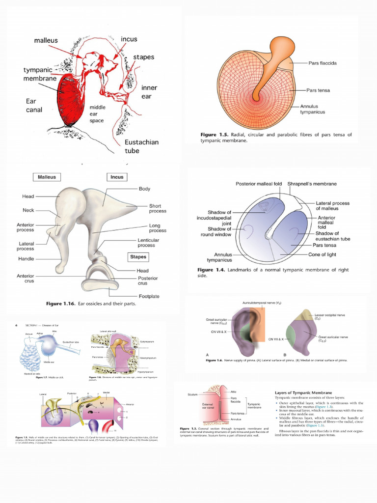Sade and Tos Retraction Membran Timpani - 230605 - 133827 | PDF