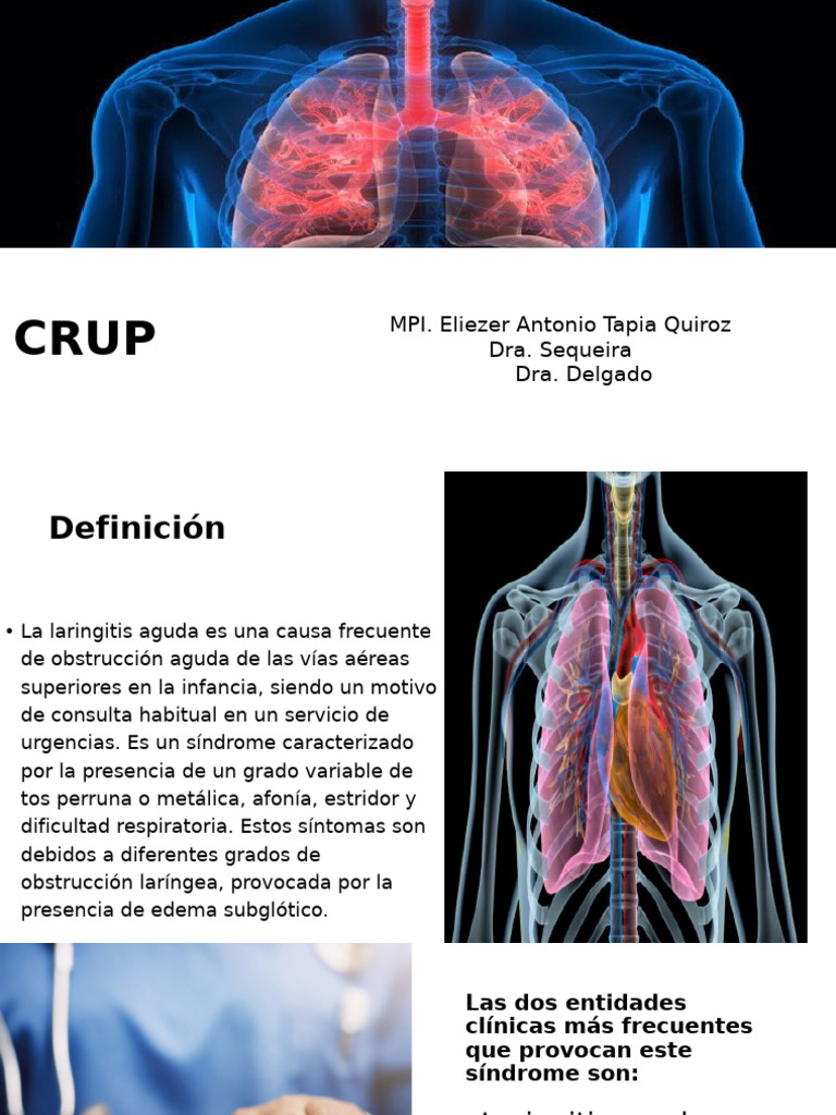 Clase Crup | PDF | Enfermedades respiratorias | Medicina CLINICA