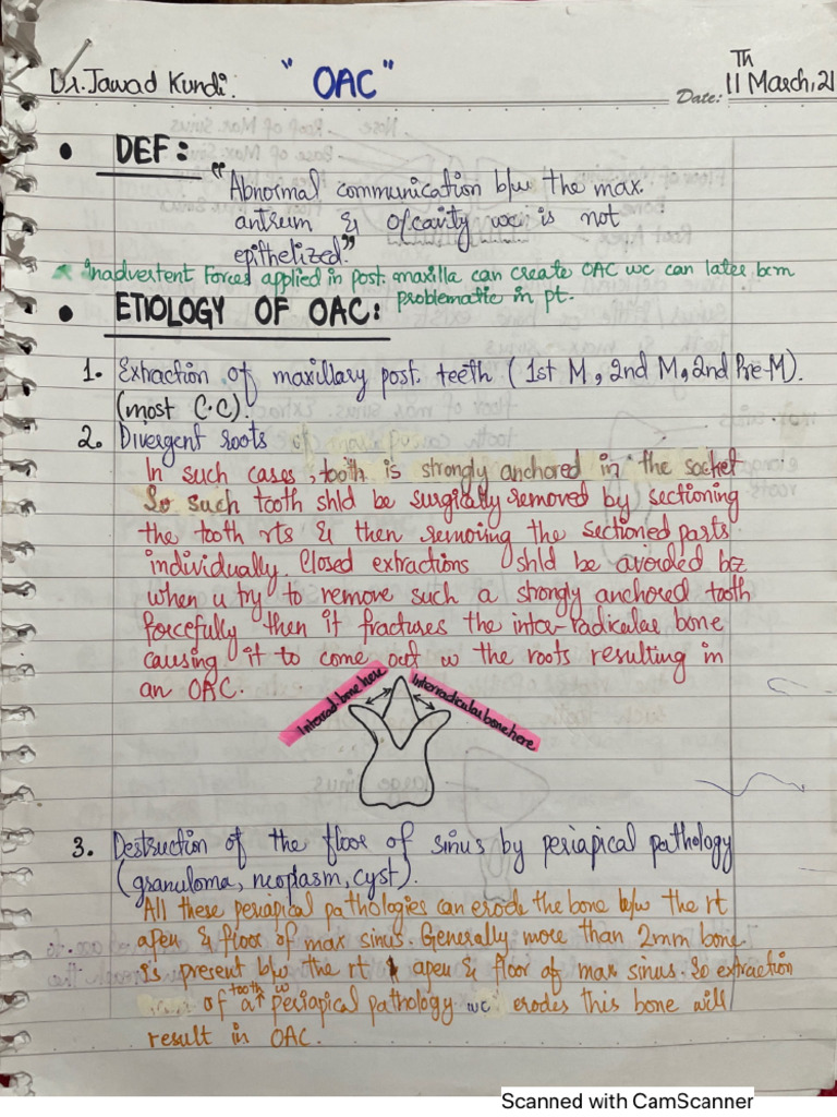 Oroantral Communication OAC | PDF