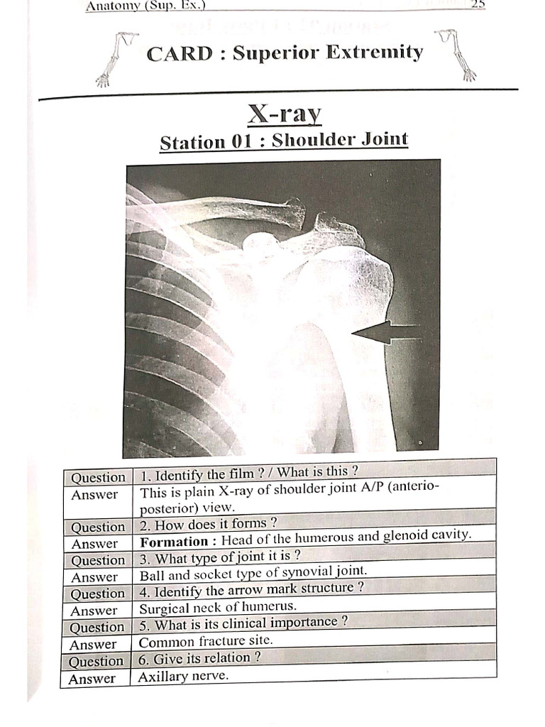 Lens Ospe Superior Extremity | PDF