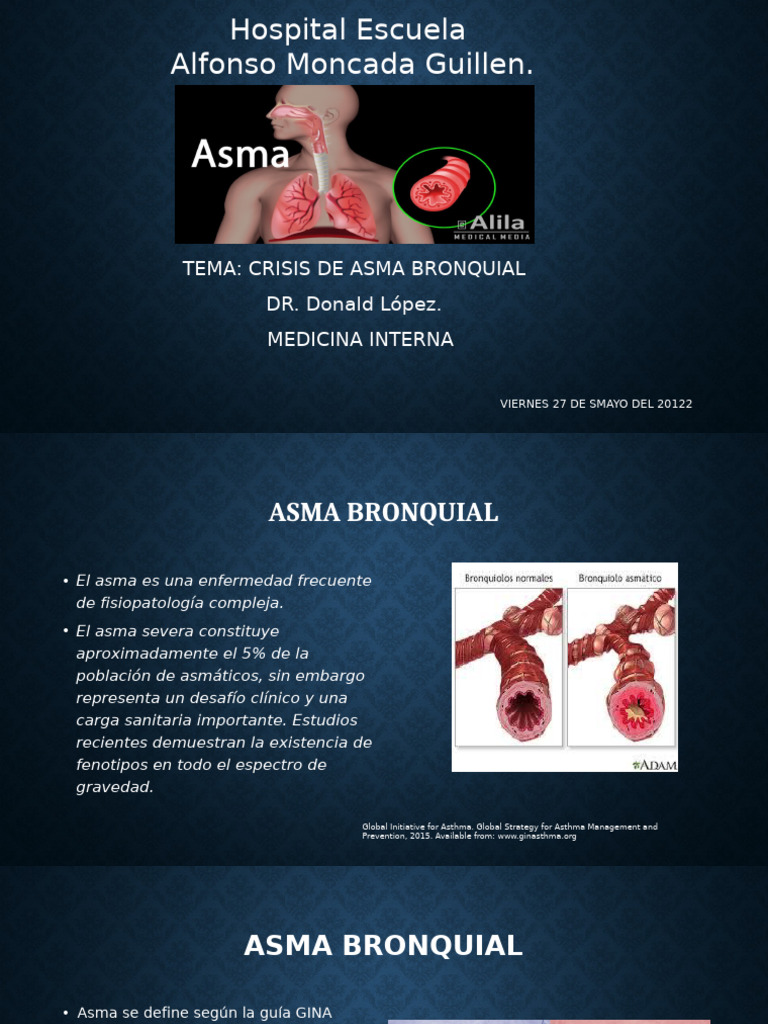Exacerbación de Asma-1 | PDF