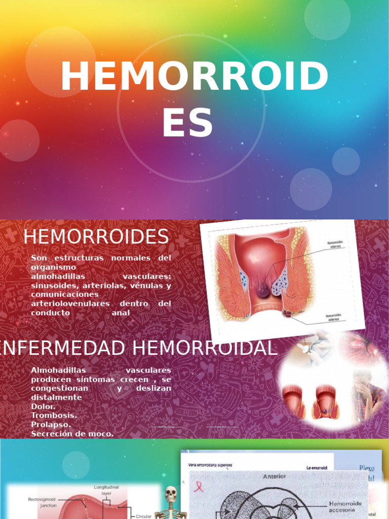 Hemorroides | PDF | Hemorroides | Medicina CLINICA