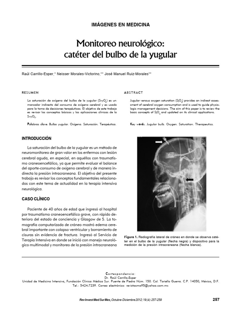 Monitoreo Neurológico: Catéter Del Bulbo de La Yugular: Imágenes en ...