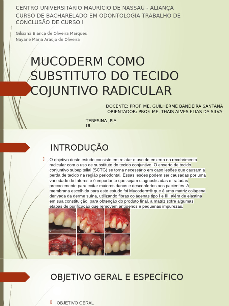 Mucoderm Como Substituto Do Tecido Cojuntivo Radicular 28 | PDF ...