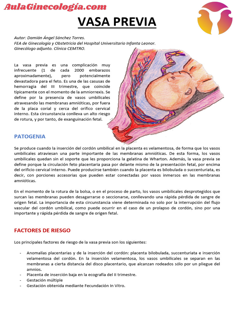 Vasa Previa | PDF | Parto | Placenta
