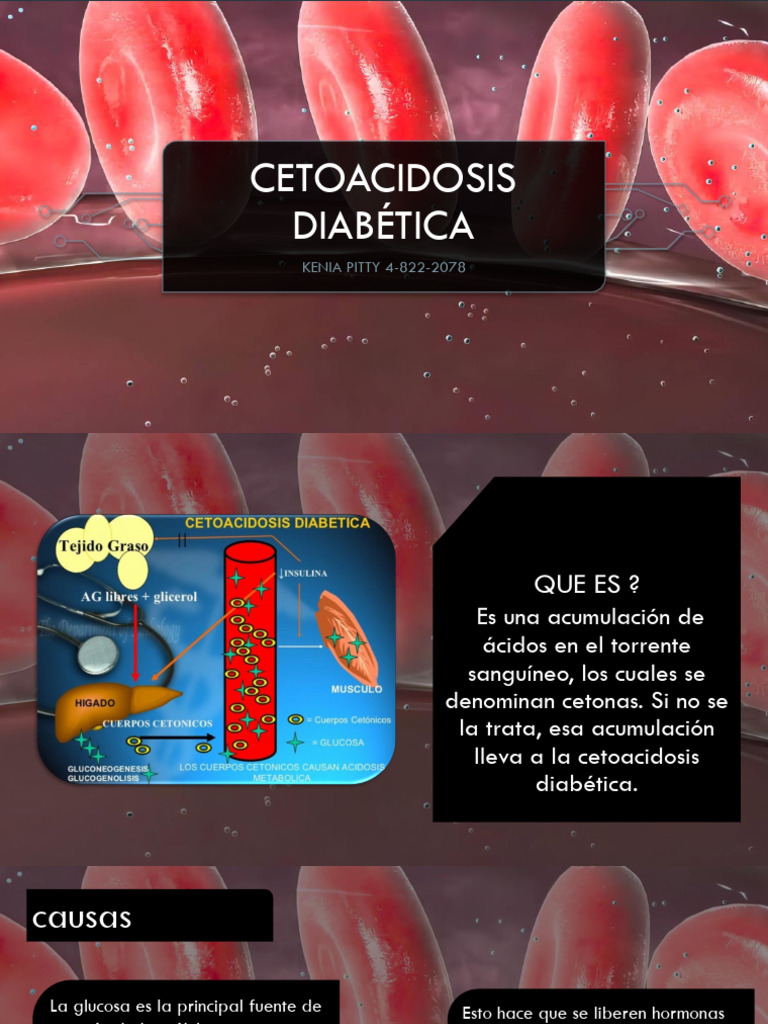 Cetoacidosis Diabética | PDF