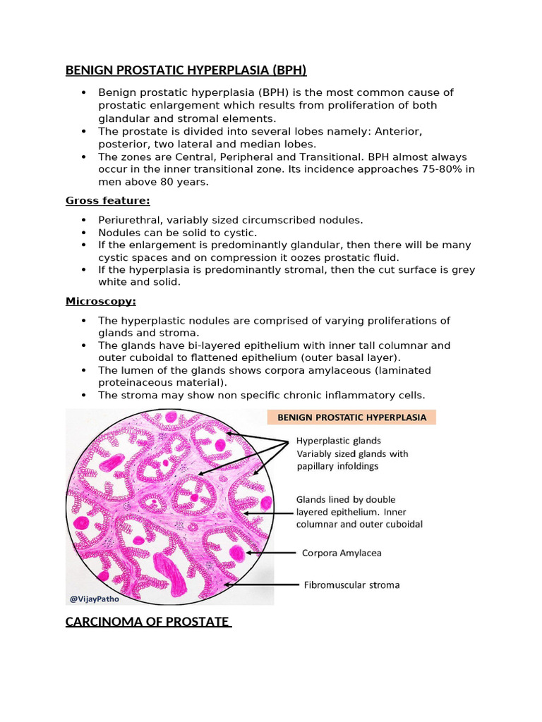 BENIGN PROSTATIC HYPERPLASIA and PROSTATIC CARCINOMA | PDF | Prostate ...