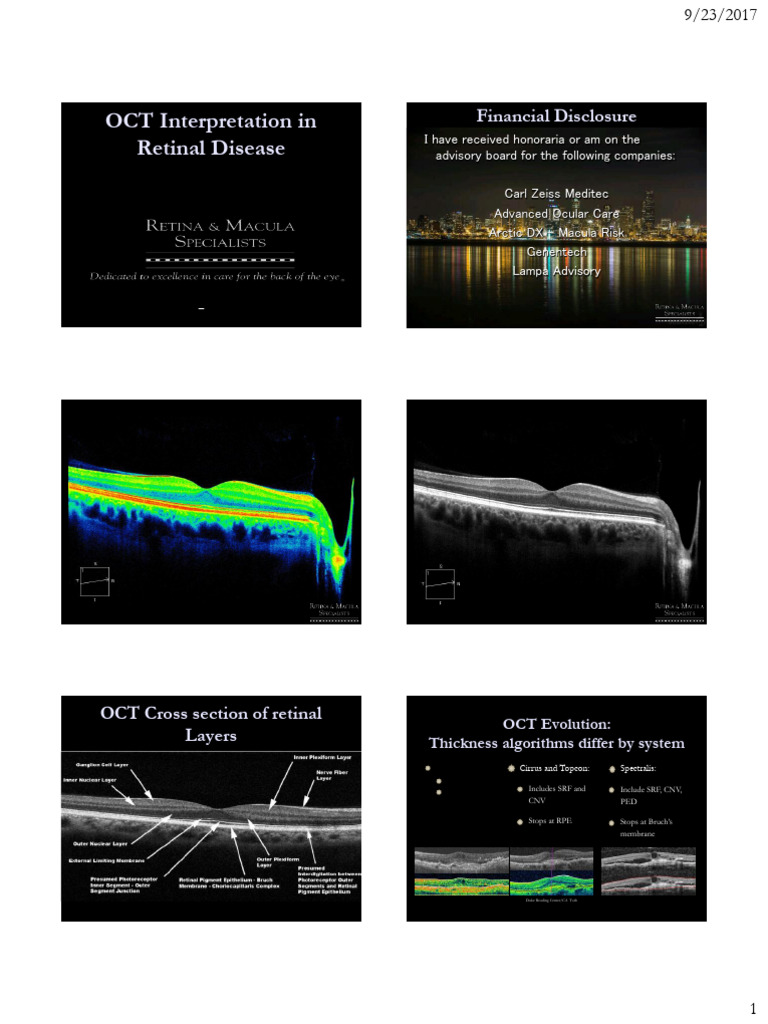 212 - OCT Interpretation in Retinal Disease (1hr) Monterey 2017 HO ...