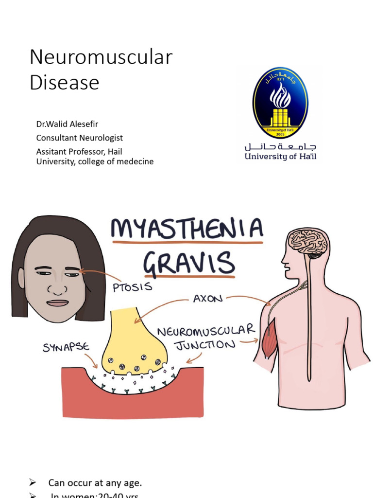 NM Disease 2024 | PDF | Neuromuscular Junction | Weakness