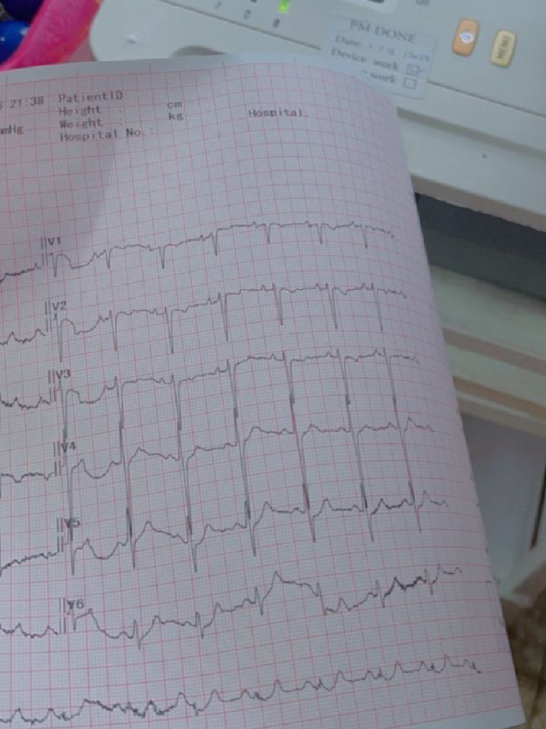 Easy ECG Guide | PDF | Electrophysiology | Cardiovascular System