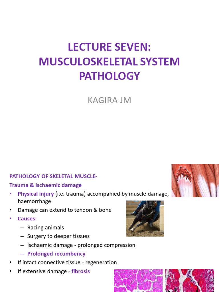 Lecture 7 - Musculoskeletal System Pathology | PDF | Bone | Osteoblast