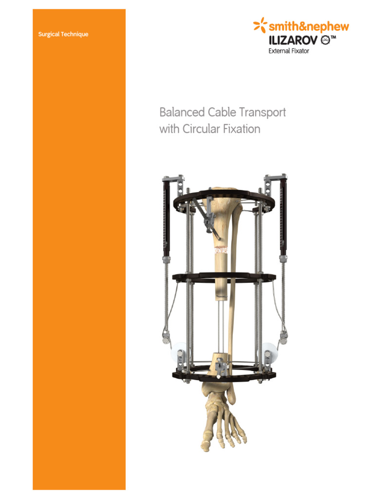 v1 71081173 Ilizarov and TSF Cables Surgical Technique 1220 | PDF