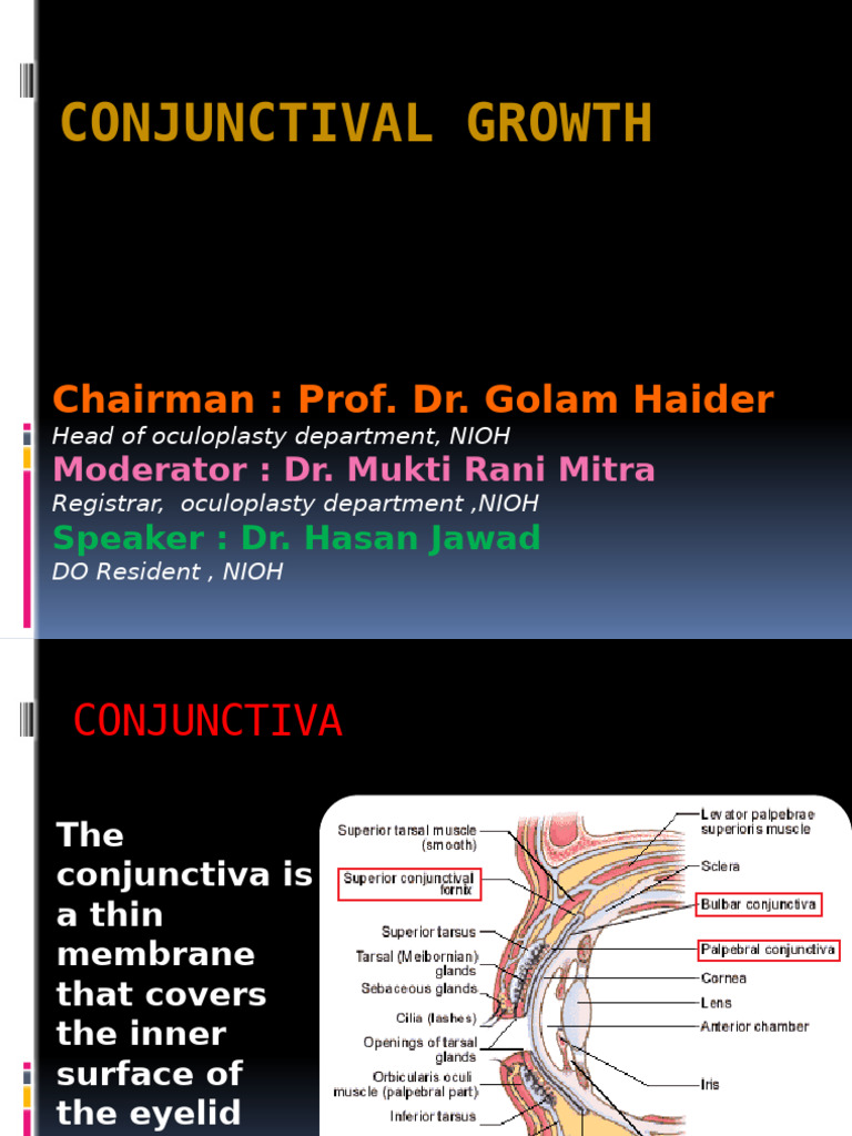 Conjunctival Growth: Types and Management | PDF