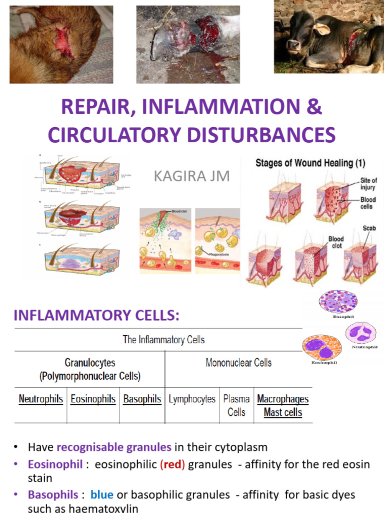 Inflammatory Cells and Exudate Functions | PDF | Wound Healing ...