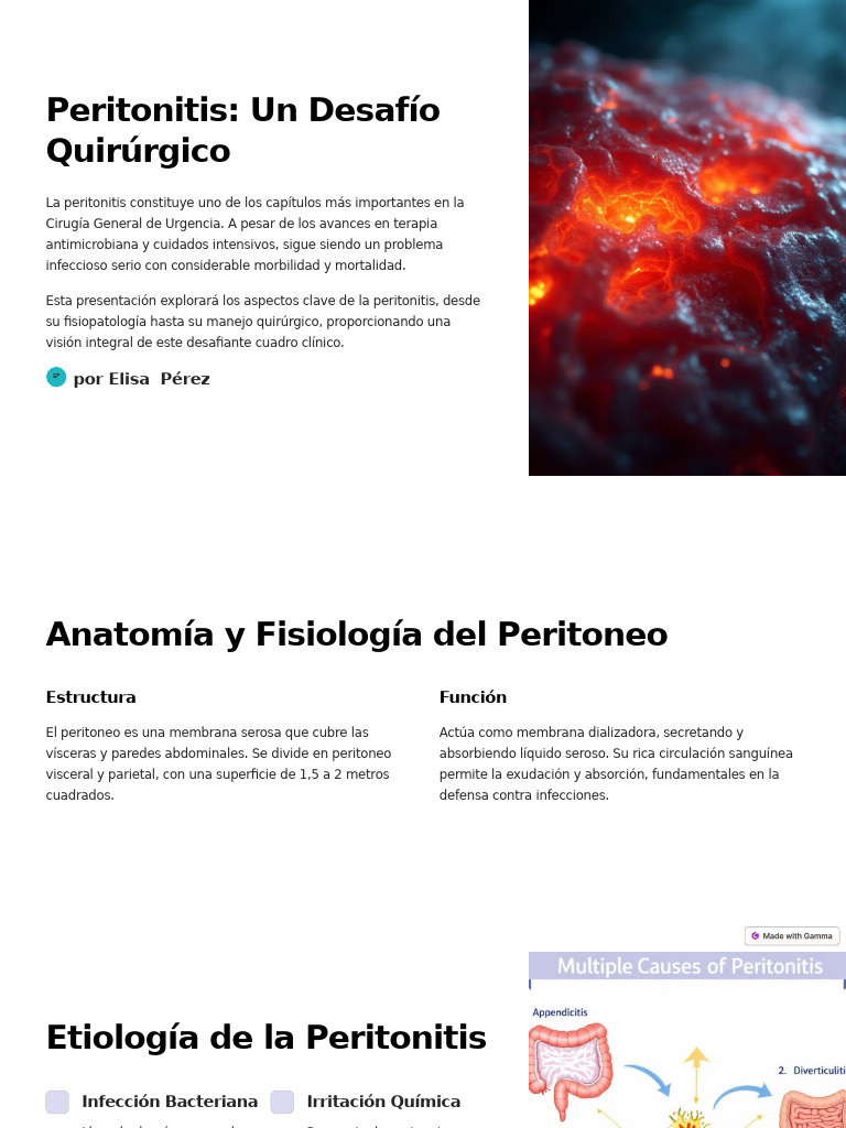 Peritonitis Un Desafio Quirurgico | PDF | Especialidades Medicas | Medicina CLINICA