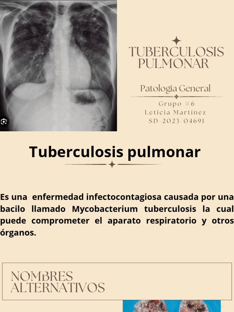 Tuberculosis Pulmonar | PDF | Tuberculosis | Medicina
