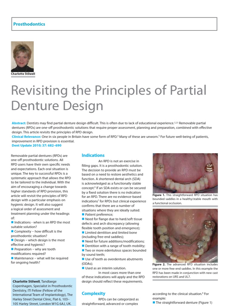 RPD STL | PDF | Dentures | Prosthodontics