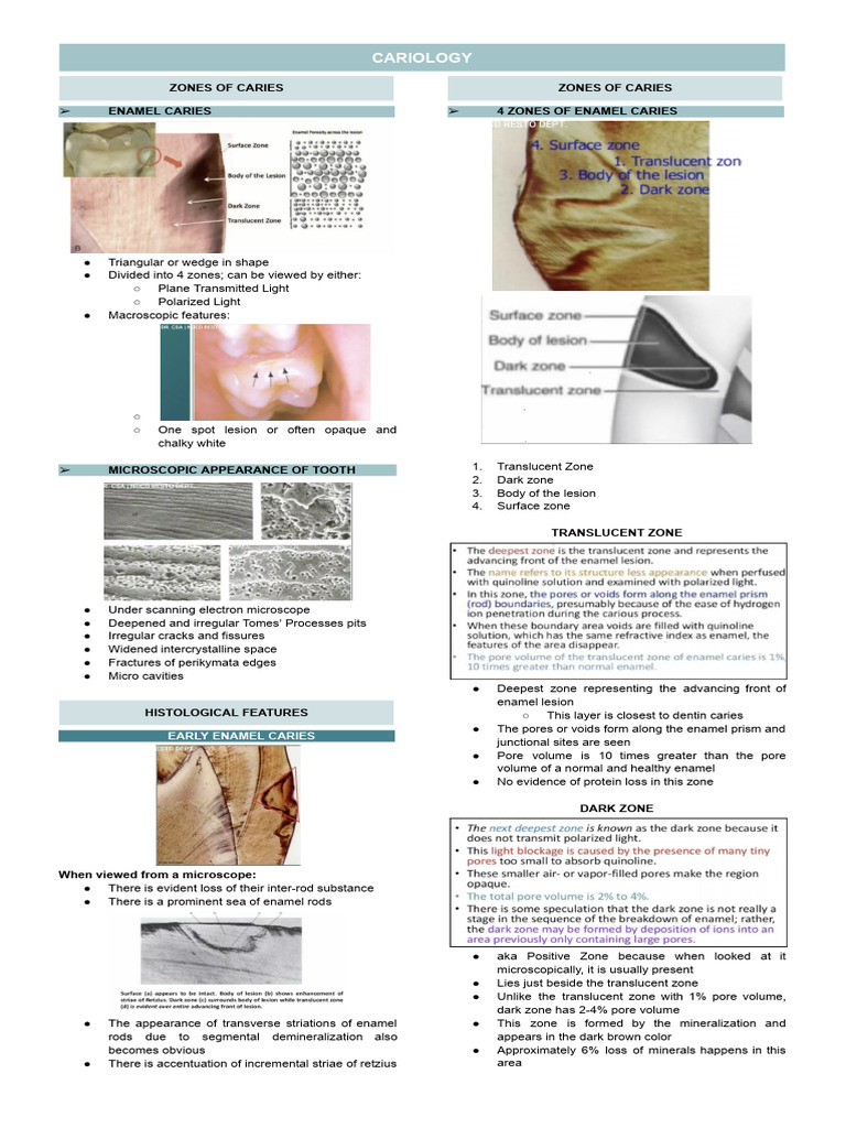 Cario-Zones of Caries | PDF | Dentin | Tooth Enamel