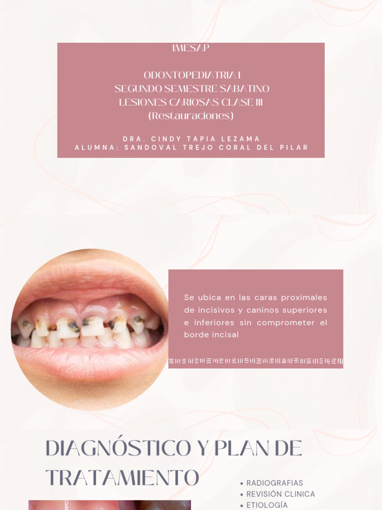 Restauraciones Clase III | PDF | Odontología | Boca