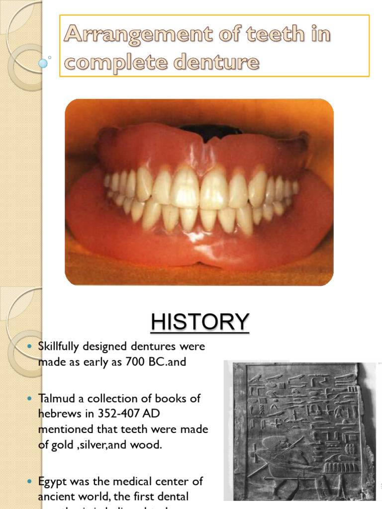 For INFO ONLY Arrangement of Teeth in Complete Denture | PDF | Dental ...