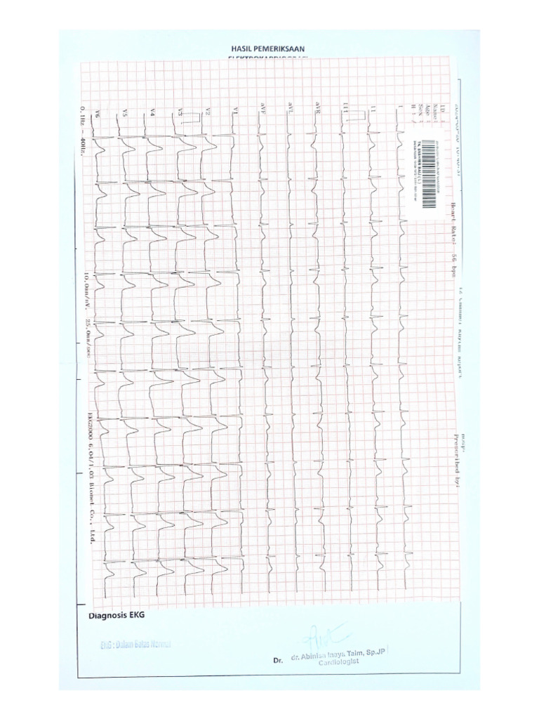 EKG | PDF