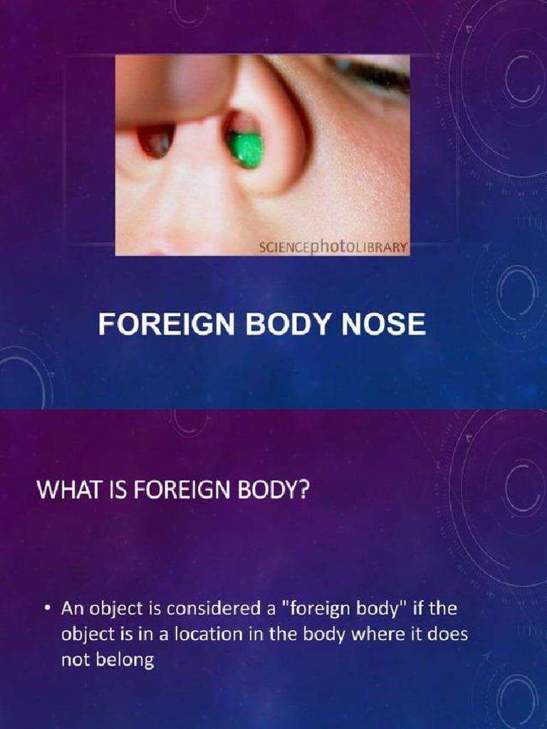 Foreign Body Nose | PDF