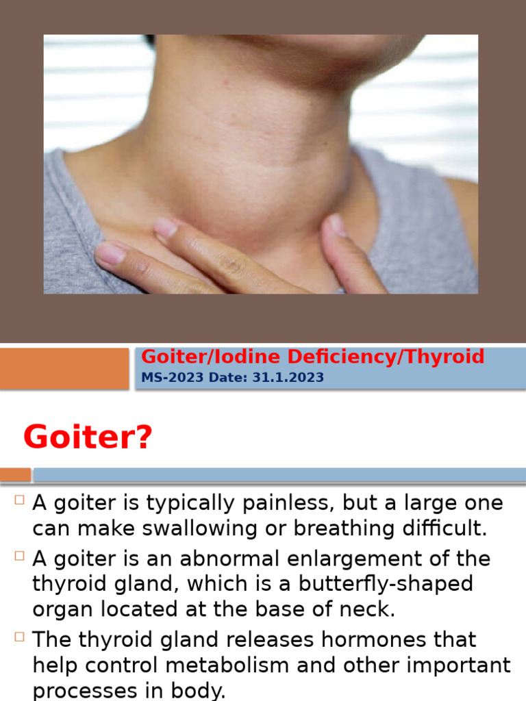 Goiter or Iodine D 2024 | PDF | Thyroid | Hypothyroidism