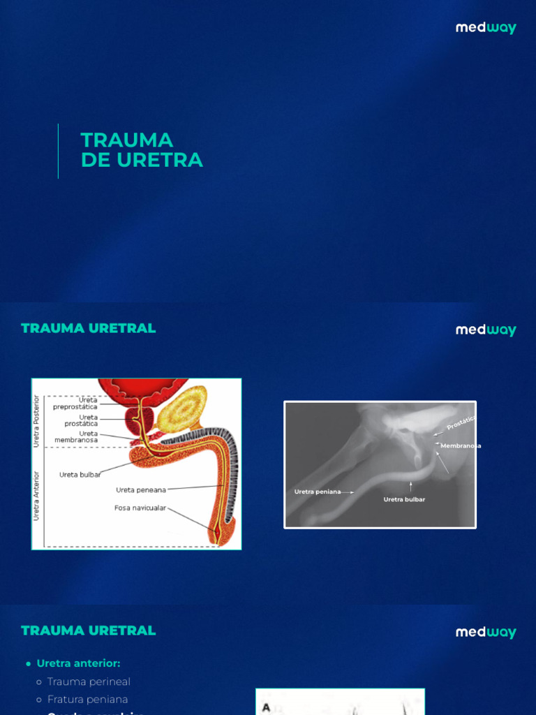 Trauma de Uretra | PDF
