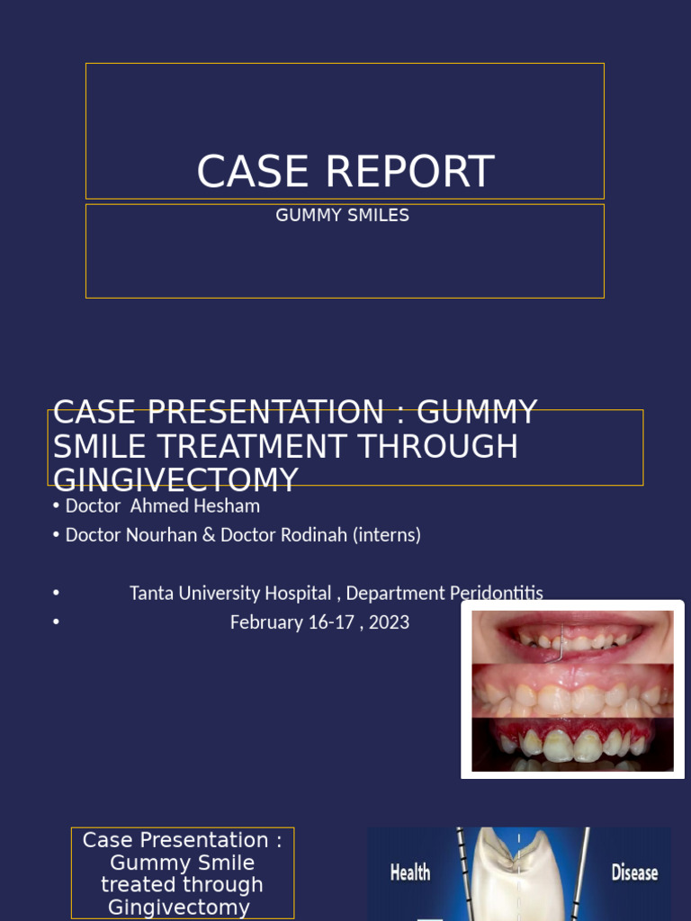 New Gummy Smile | PDF | Periodontology | Dentistry Branches