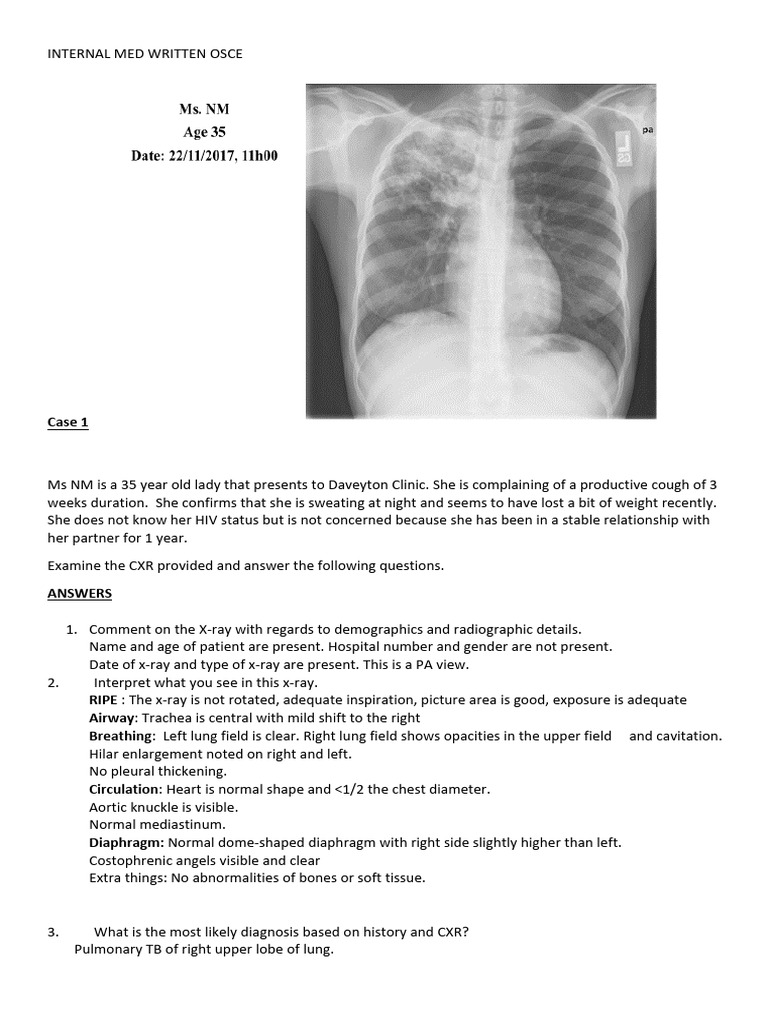 Internal Med Written Osce | PDF | Anemia | Diseases And Disorders