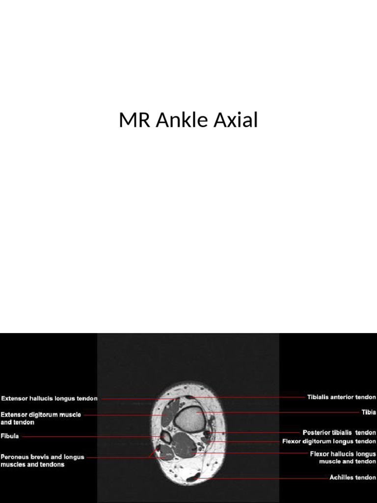 MR Ankle Axial | PDF