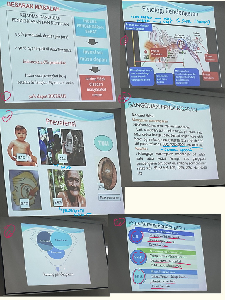 Gangguan Pendengaran DR Rano | PDF