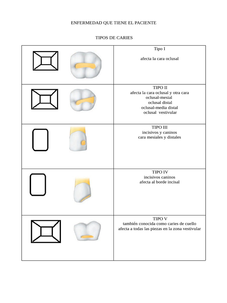 Tipos de Caries Dentales | PDF