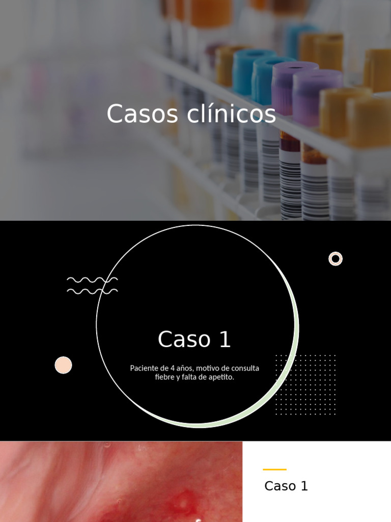 Faringitis Casos Clinicos | PDF