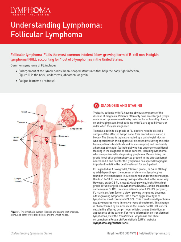 Understanding Follicular Lymphoma | PDF | Lymphoma | Lymphatic System