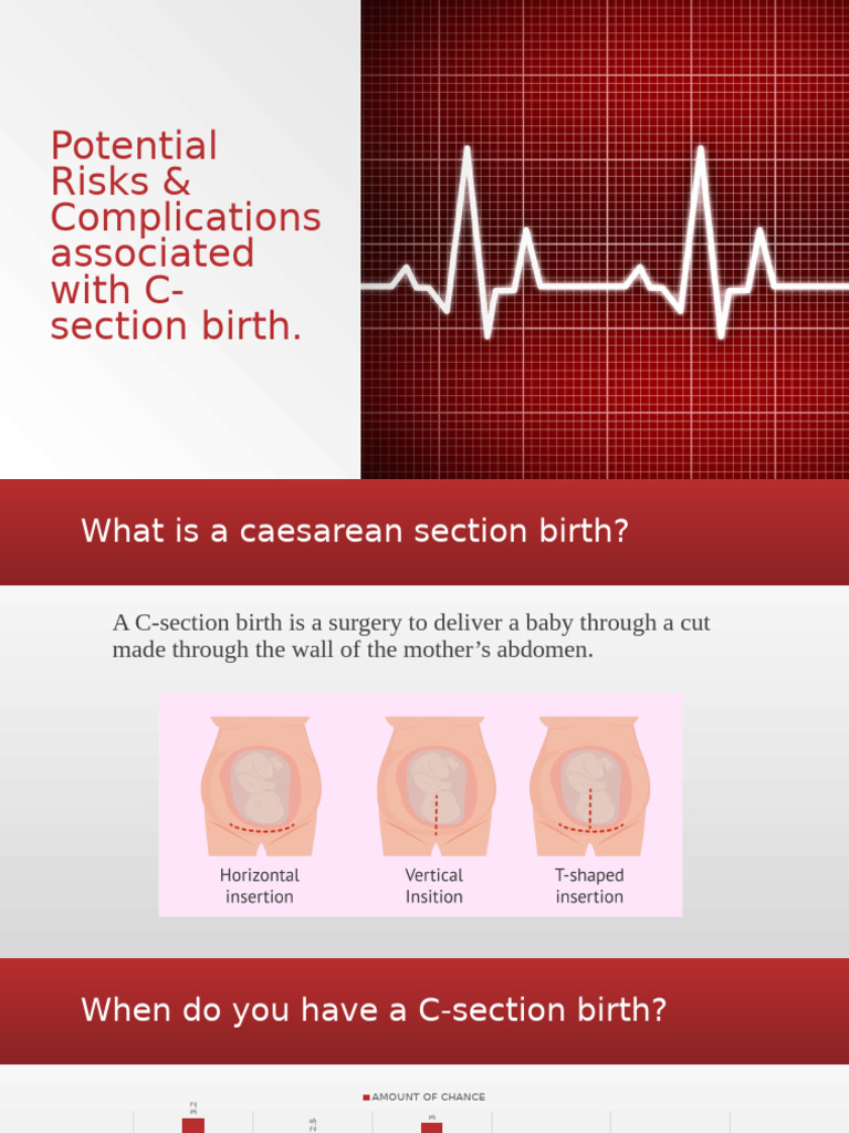 Potential Risks & Complications Associated With C-Section Birth | PDF
