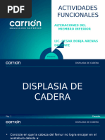 Proceso de Stieda y su tratamiento | PDF | Tobillo | Cirugía