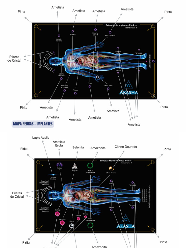 Mapa de Piedras para Implantes | PDF