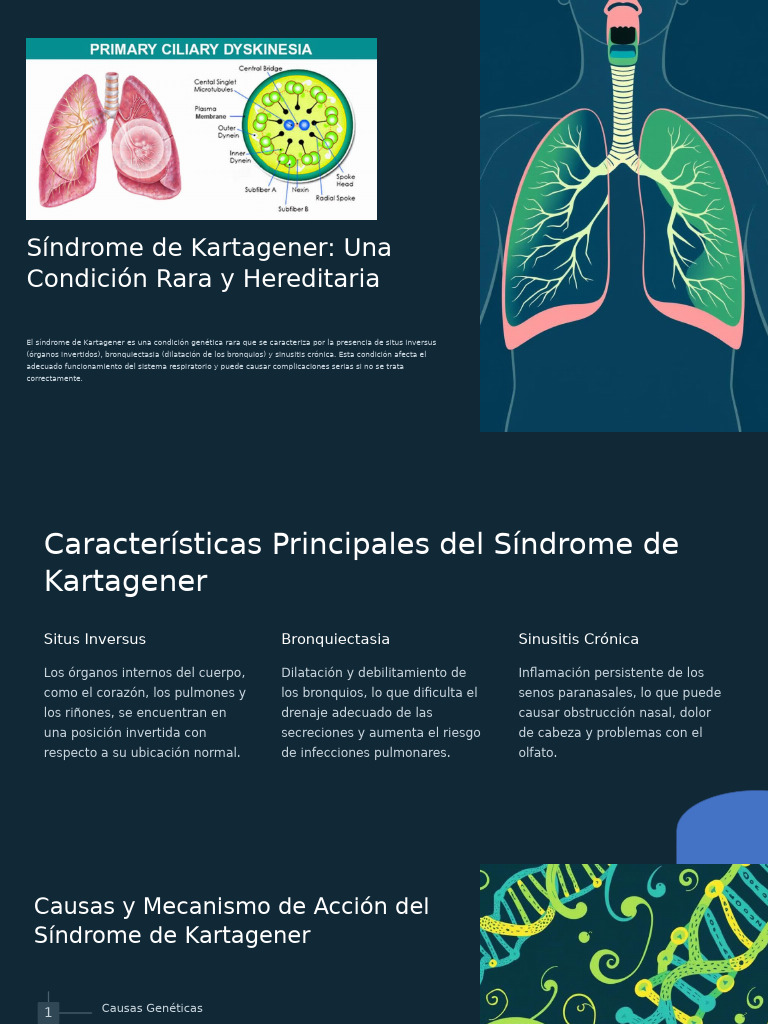 Síndrome de Kartagener: Causas y Tratamiento | PDF | Imagenes medicas ...
