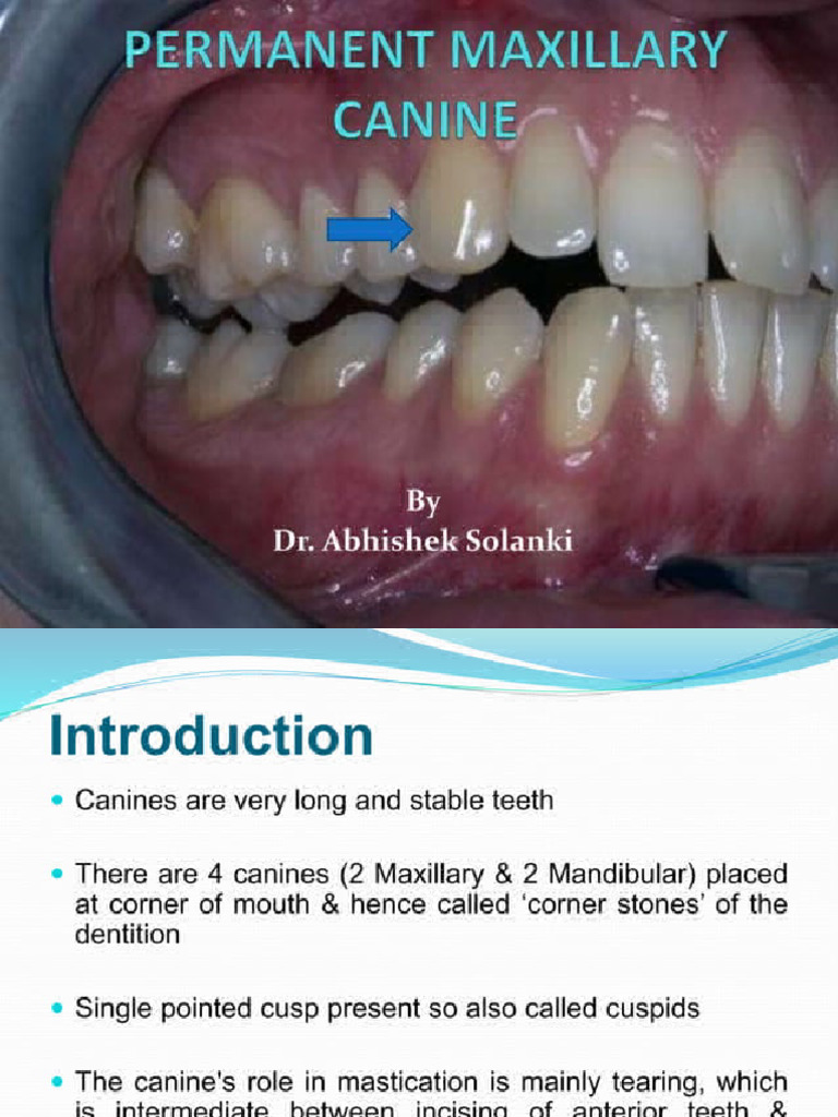 Maxillary and Mandibular CANINES | PDF