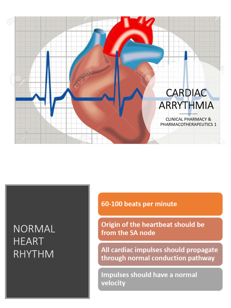 Arrythmia Pdf Cardiac Arrhythmia Medical Specialties