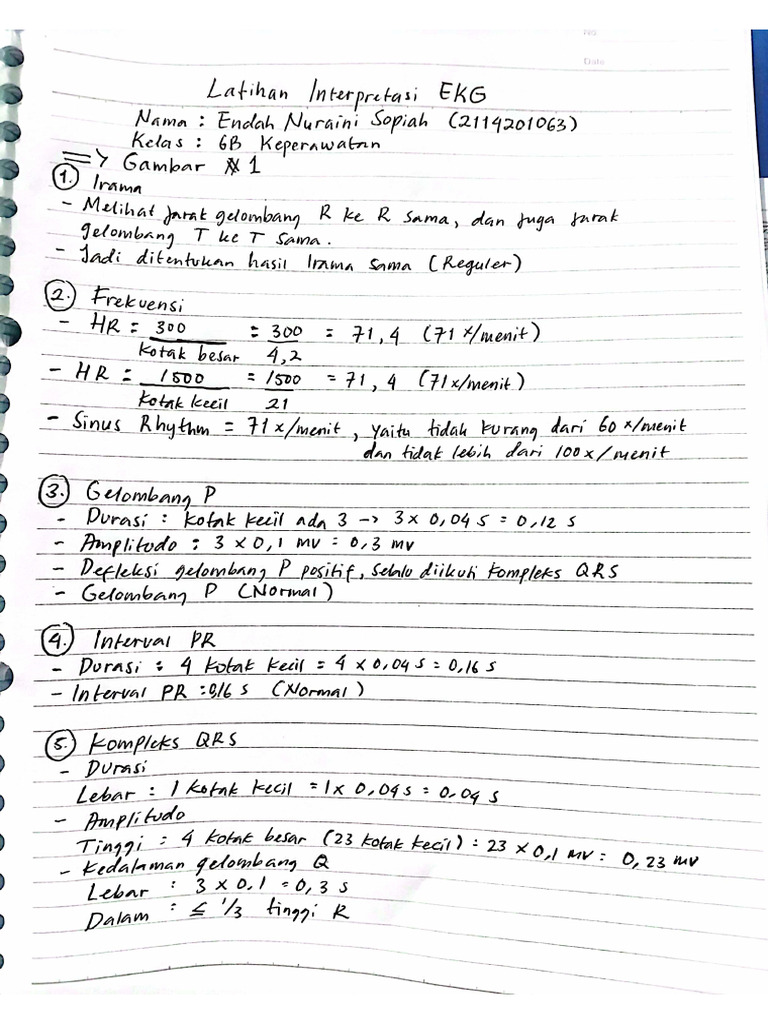 Latihan EKG - Endah Nuraini Sopiah (2114201063) | PDF